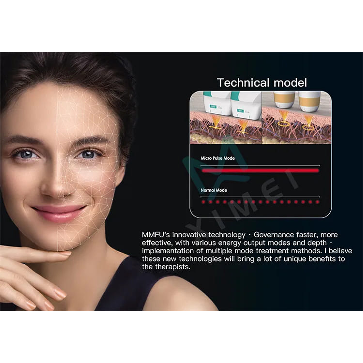 HIFU 12D MPT VERTICAL