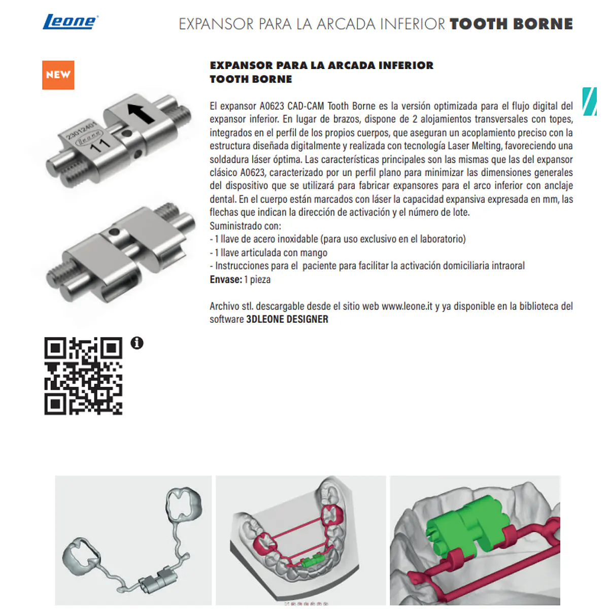 EXPANSOR PARA ARCADA INFERIOR CAD-CAM EXPANDER