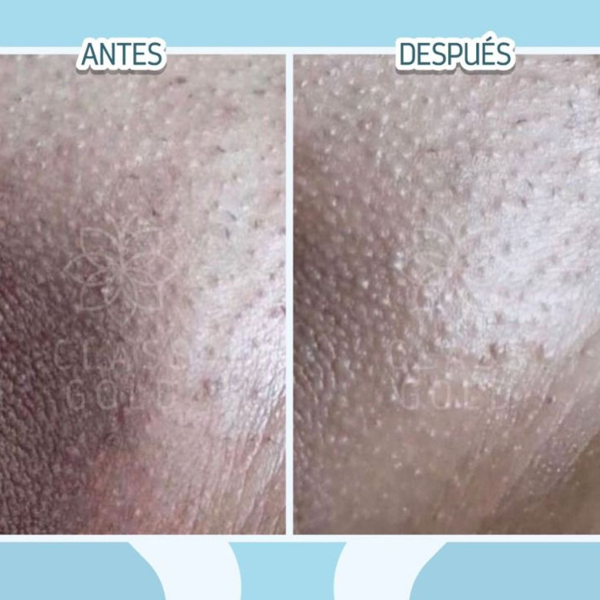 Kit Intimo #3 - Jabon intimo y Dermoaclarante