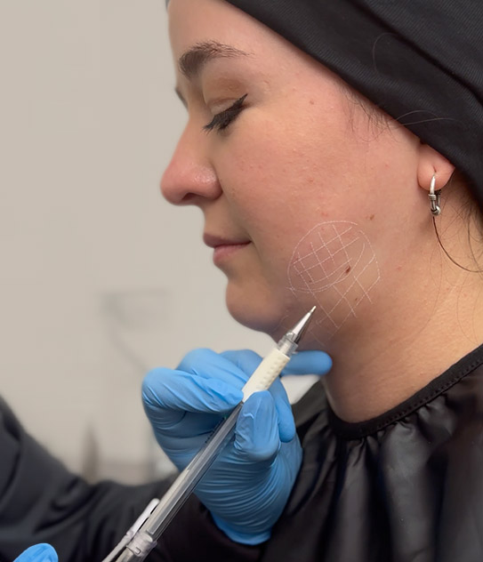 Lipolax, Mesolipopapada 3 sesiones | Clínica Estétika Médica