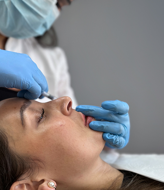 Botox® 3 zonas + Relleno de labios | Clínica Estétika Médica