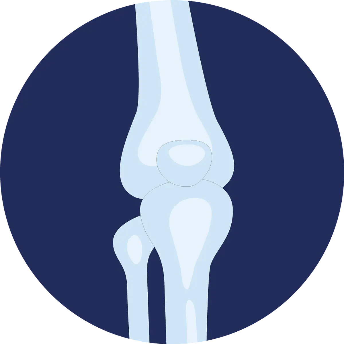 Rodilla