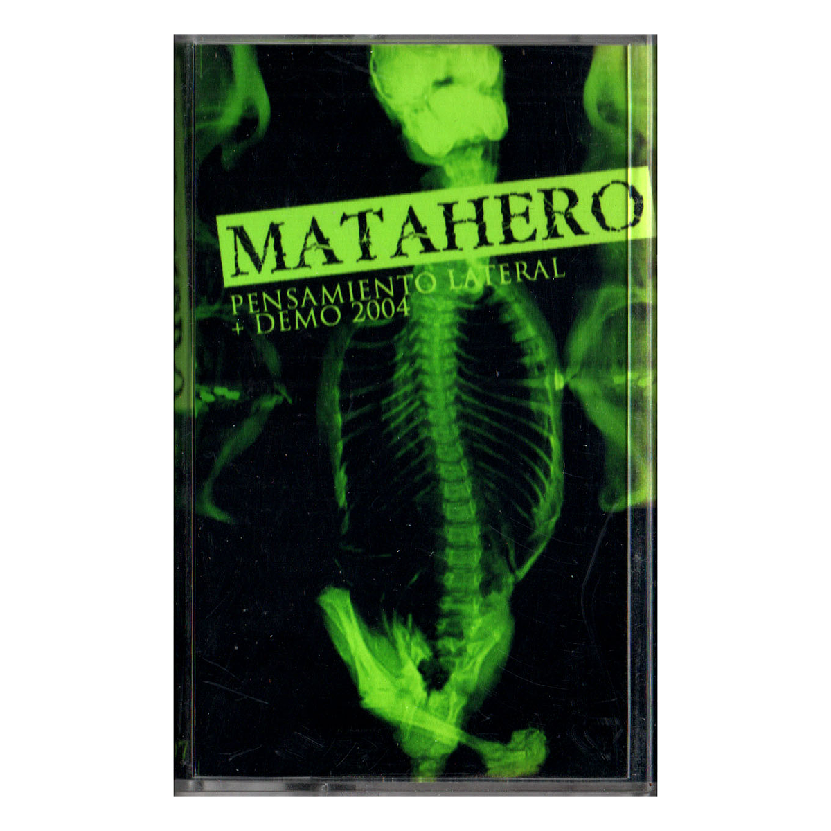 Matahero - Pensamiento Lateral + Demo 2004 | Record Boy Discos