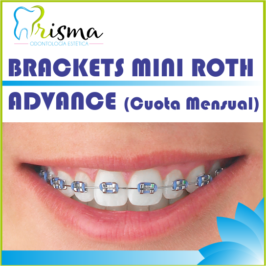 BRACKETS MINI ROTH ADVANCE PRISMA