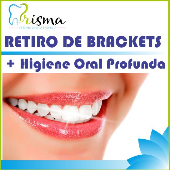 RETIRO DE BRACKERS + HIGIENE ORAL PROFUNDA