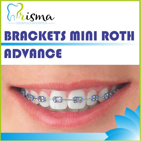 BRACKETS MINI ROTH ADVANCE PRISMA ODONTOLOGIA
