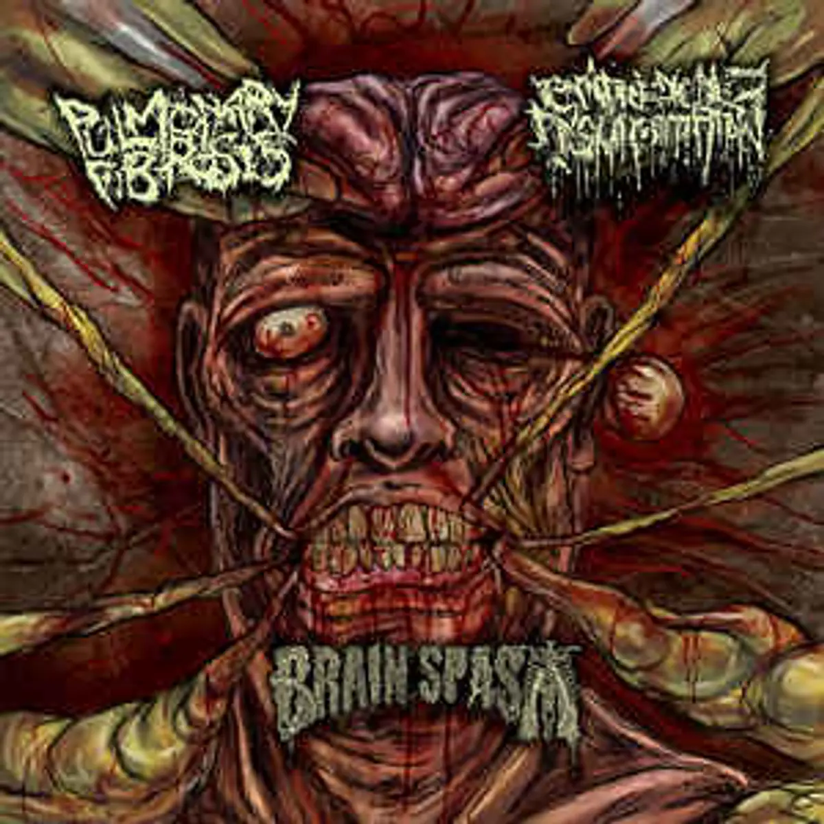 PULMONARY FIBROSIS / BRAIN SPASM / ENTRENCHED INGURGITATI...