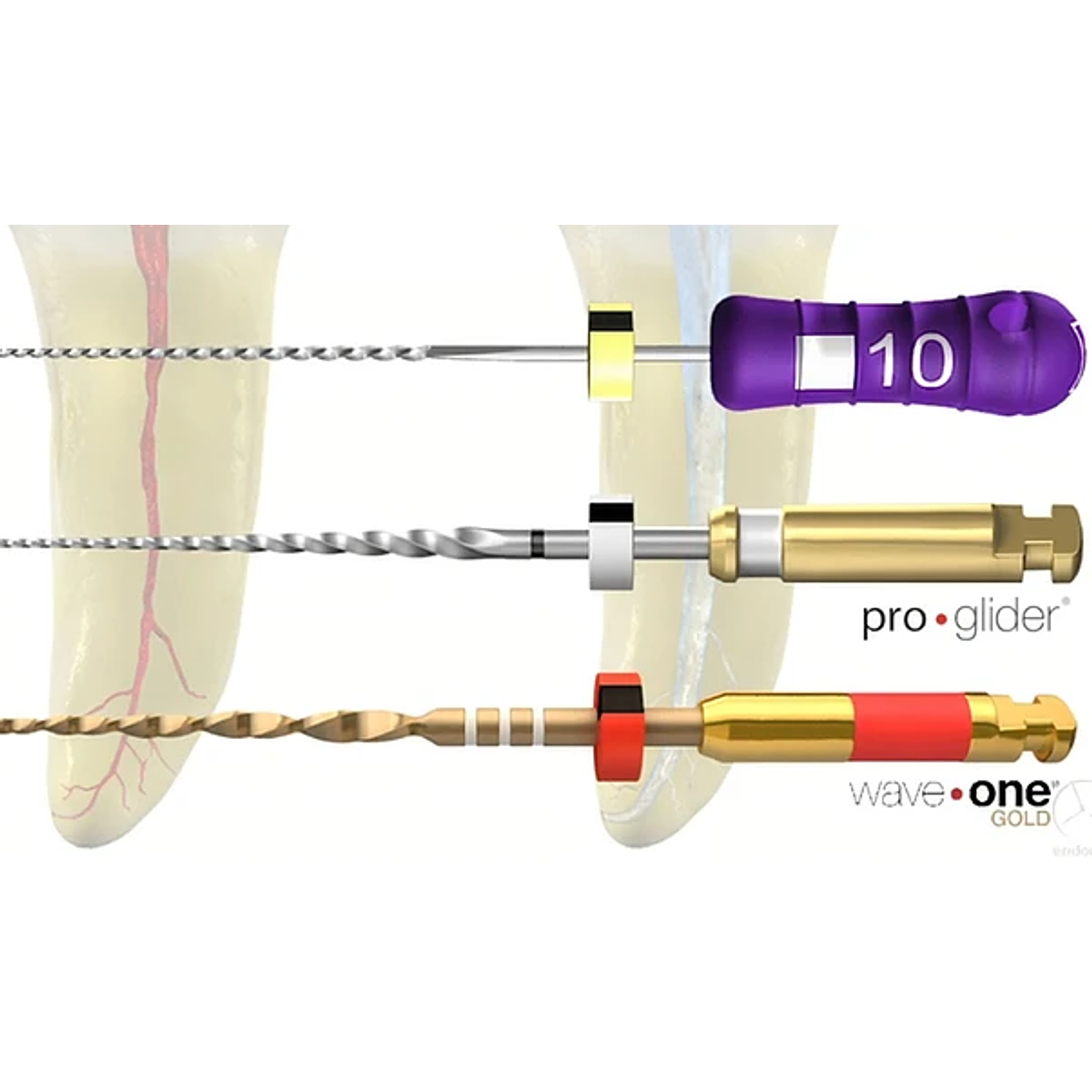 WAVEONE GOLD SEQUENCE | Vicedent